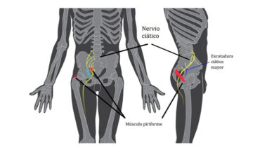Músculo piramidal o piriforme: anatomía y síntomas del síndrome ...