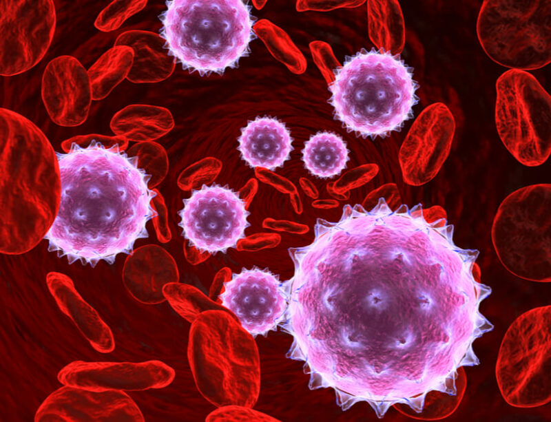 VIH/SIDA: ¿qué es, qué síntomas tiene y cómo se contagia? - Viviendo La ...